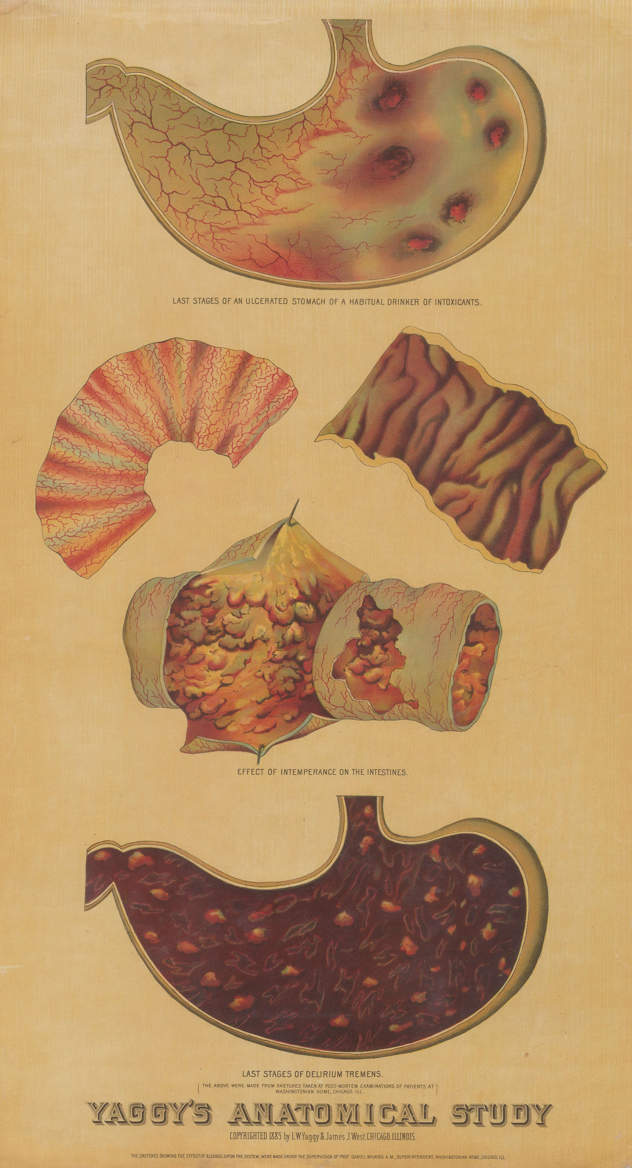 Levi Walter Yaggy, Anatomy - Stomach and Intestines, 1886 | The Map House